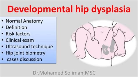 Ultrasound Of Developmental Dysplasia Of Hip Joint Drmohamed Soliman