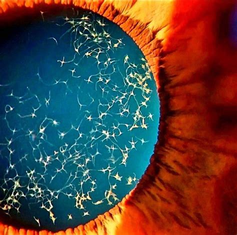 I Have Actual Stars In My Eye Epicapsular Stars Rmildlyinteresting