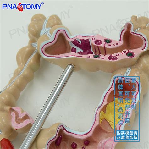 Human Model Simulation Human Colon Anatomy Model Anorectal Intestinal Gastrointestinal Digestive
