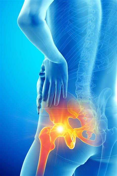 Extreme Hip Pain In Adults Hip Pain In Adults Treatment Jqczc
