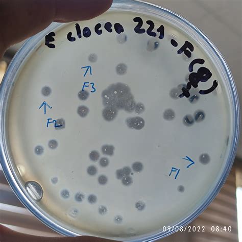 Enterobacter Cloacae Bacteriophage 200221f Mikroliz