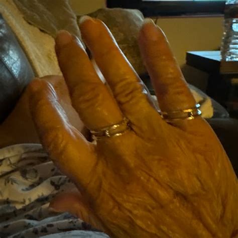 Thumb Mcp Splint Ring Pinky Finger Palm Support Ring Saddle Joint Splint Support Arthritis