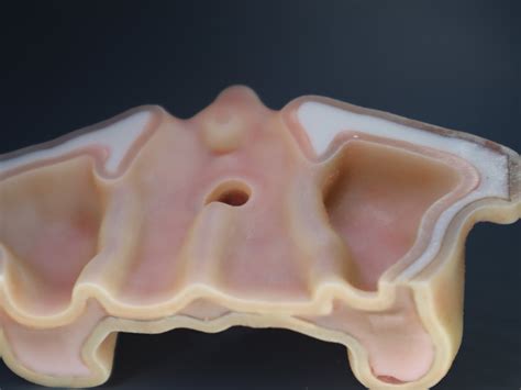 Maxillary Extraction W Sinus Cavity And Pulp — Biomed3d