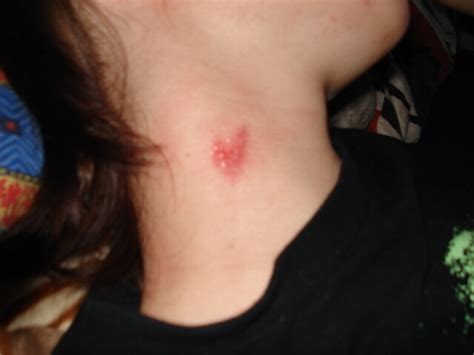 Home Pics 8201 Nudephotos5663 28623ポルノ写真 Eporner