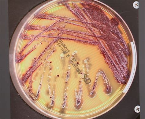 Hi Technology Beating Bacteria Swpictures