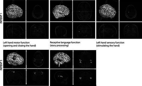Examples Of Original Fmri Data For Motor Sensory And Language Download Scientific Diagram