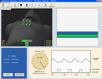 Respiratory Gating Advanced Radiation Centers Of New York