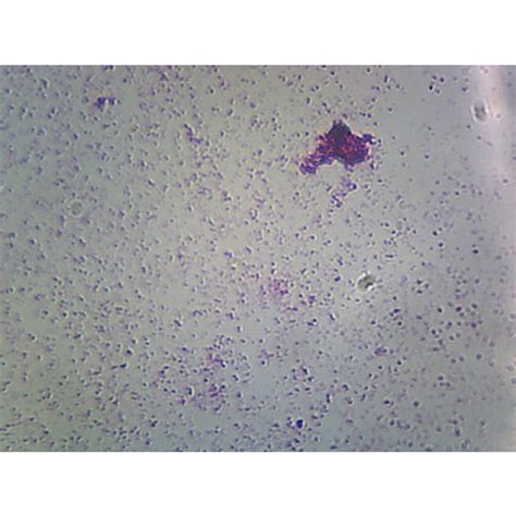Prepared Microscope Slideazotobacter And Rhizobium Leguminosarum