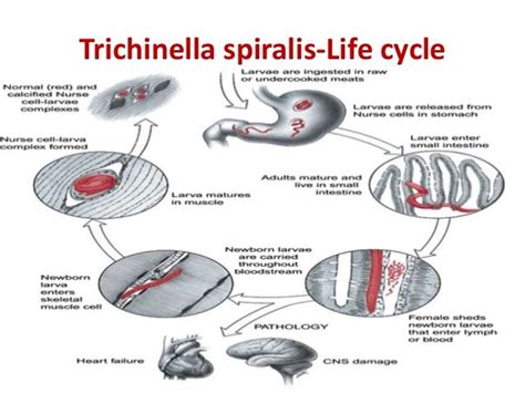 Trichinellaspiralislifecycle