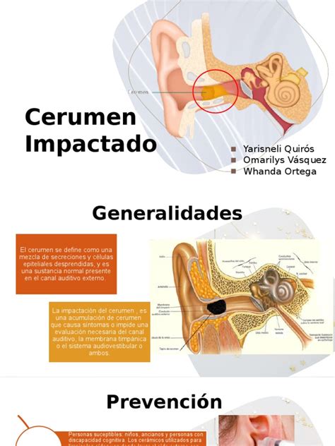 Cerumen Impactado Pdf Especialidades Medicas Medicina Clinica