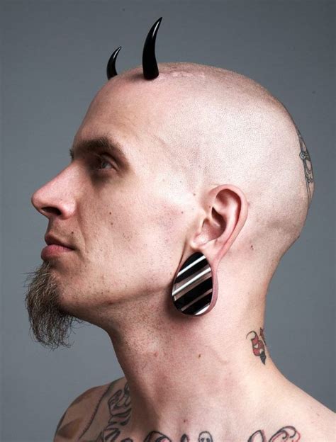 A Newbies Guide To Dermal Implants