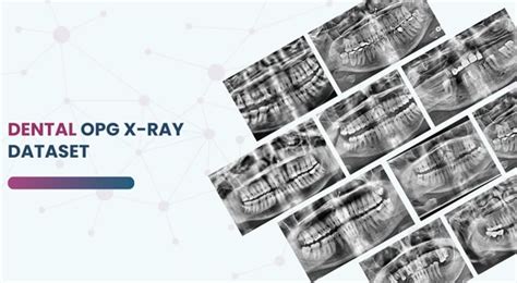 Dental Opg X Ray Dataset Classification And Object Detection
