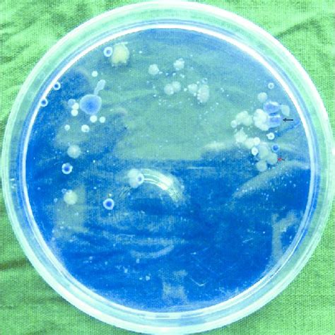 Growth Of Streptococcus Mitis Seen As Small Flat Hard Colonies Blue