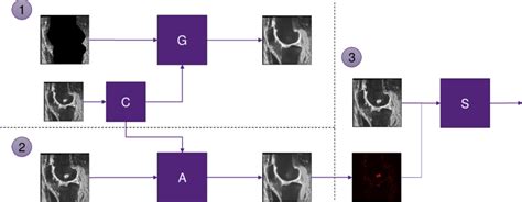 Overall Pipeline For Our Method Including Anomaly Detection And The