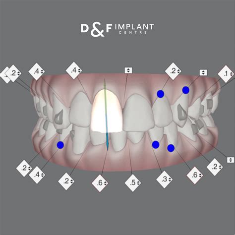 🦷using Clincheck Software Our Dandf Dental Clinic