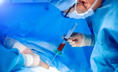 Bone Marrow Transplant Dental Extraction At Winifred Thompson Blog