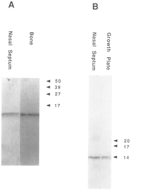 Warfarin Syndrome Semantic Scholar