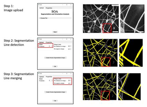 Automatic Identification Of Dendritic Branches And Their Orientation