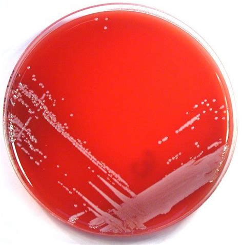 Staphylococcussaprophyticusagar Sangre Microbiología Bacteriologia