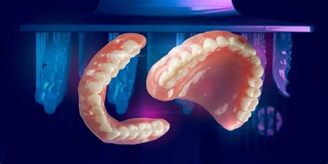 The Lucitone Denture Advantage [best Practices Advice] Stomadent