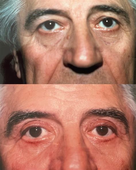 Borko Djordjevic Md Borkodjordjevicmd • Instagram Photos And Videos