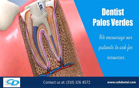 Dentist Palos Verdes Tips To Help You Select The Best By South Bay