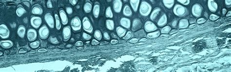 Matrix Iq® Dermis Tissue Regenix