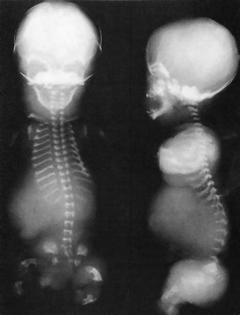 Congenital Skeletal Anomalies Clinical Tree