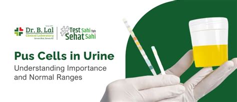 Pus Cells In Urine 1 2 2 3 4 6 Hpf Normal Range Purpose Of Urine Test