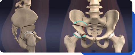Hip Preservation Surgery In Dubai