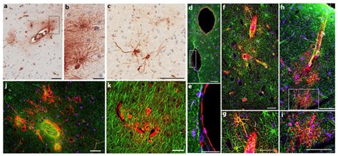 Internalization Of Bloodborne Fibrinogen In Astrocytes And Neurons