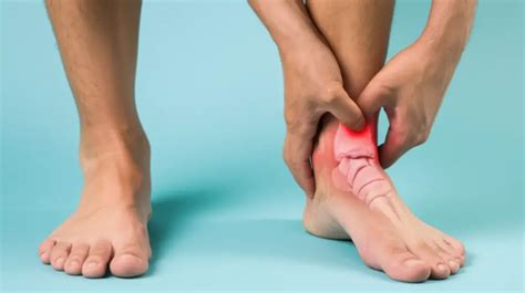 Ankle Gout Symptoms Causes And How To Find Relief Relivehealth