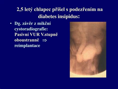 Ppt Polyurie Polydipsie Powerpoint Presentation Free Download Id