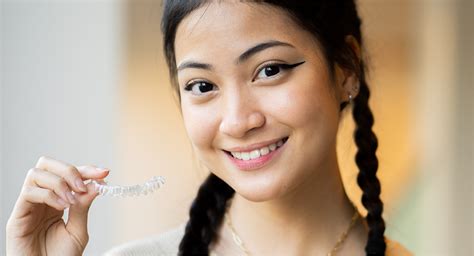 Comparison Between 3 Common Types Of Dental Braces In Malaysia Conventional Self Ligating And