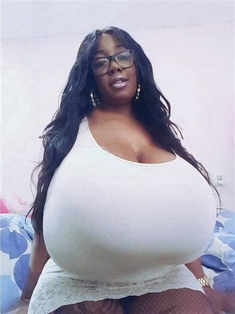 Mengaku Idap Gigantomastia Wanita Ini Miliki Payudara Raksasa