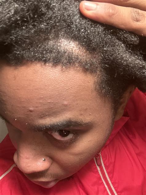 Hol On Is This Normal I Have A Front Taper So Maybe Its Just That Scrolller