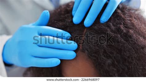 Categoría Dandruff Dermatologist De Imágenes Fotos De Stock E