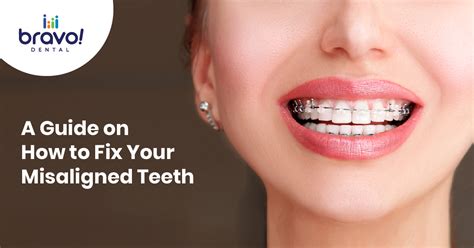 Can Misaligned Teeth Cause Pain At Ola Cahoon Blog