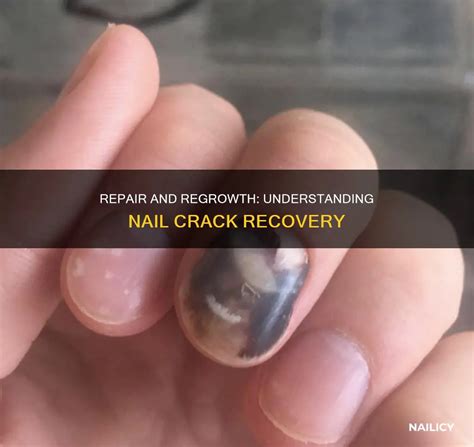 Repair And Regrowth Understanding Nail Crack Recovery Nailicy
