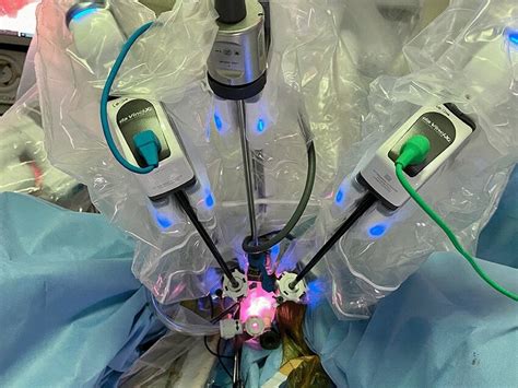 Demonstration Of Gelpoint Mini® Advanced Access Platform Applied