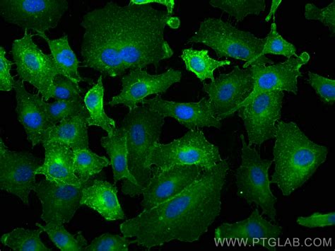 Cd55 Antibody 26580 1 Ap Proteintech