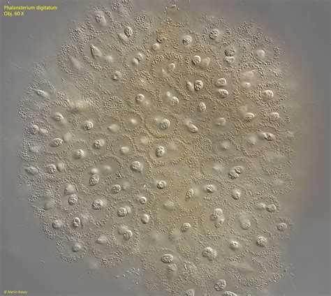 Phalansterium Digitatum Real Micro Life