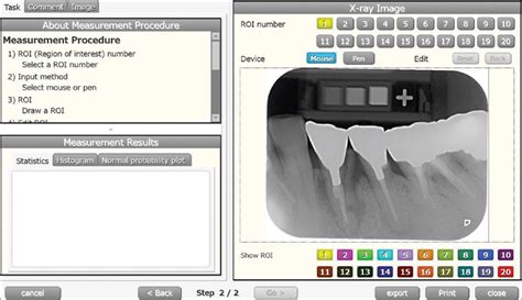 Alveolar Bone Density Based On Image Density Of Intraoral Ra
