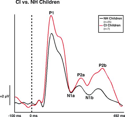 Visual Evoked Potential Vep Pattern B In Normal Hearing Nh And Download Scientific Diagram