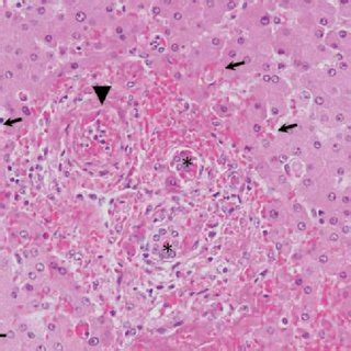 Pdf The Pathology Of Eclampsia An Autopsy Series