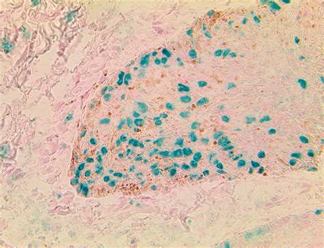 Tintofast Sox 10 Antibody Bsb 62 Bio Sb
