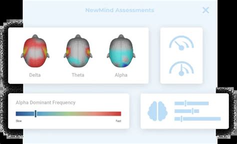 Neurofeedback Software And Training Qeeg Report Brain Maps