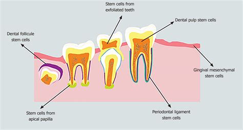 Fact Check Dental Stem Cells Can Build Mineralized Tissue Faster Than