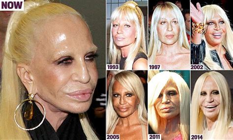 How Donatella Versace Transformed Herself Into A Human Waxwork With