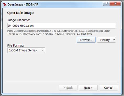 Figure 1 From Digital Fabrication Of Patient Specific 3d Printed